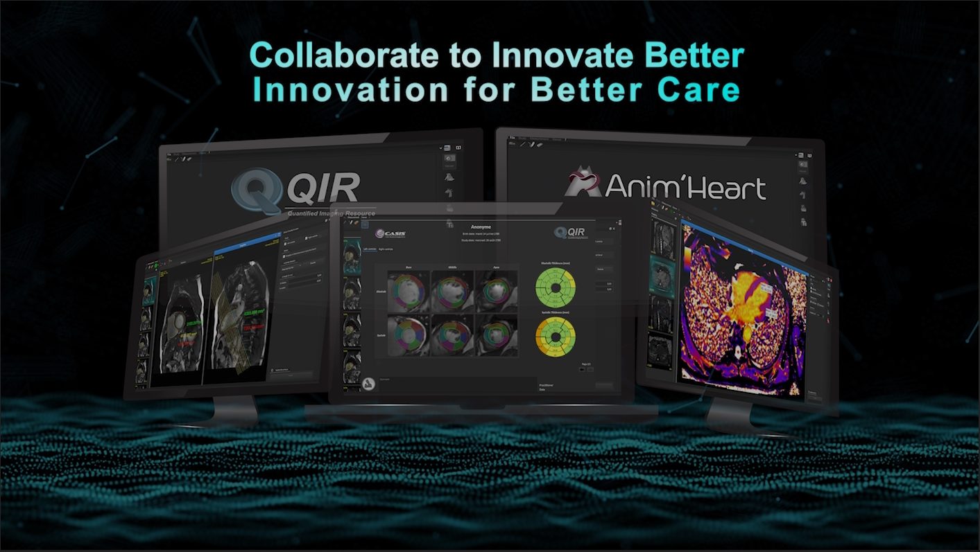 CASIS - CArdiac Simulation & Imaging Software | Homepage - Fr